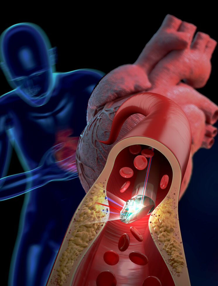 Hybrid 3D-printed intravascular imaging device for accurate detection ...