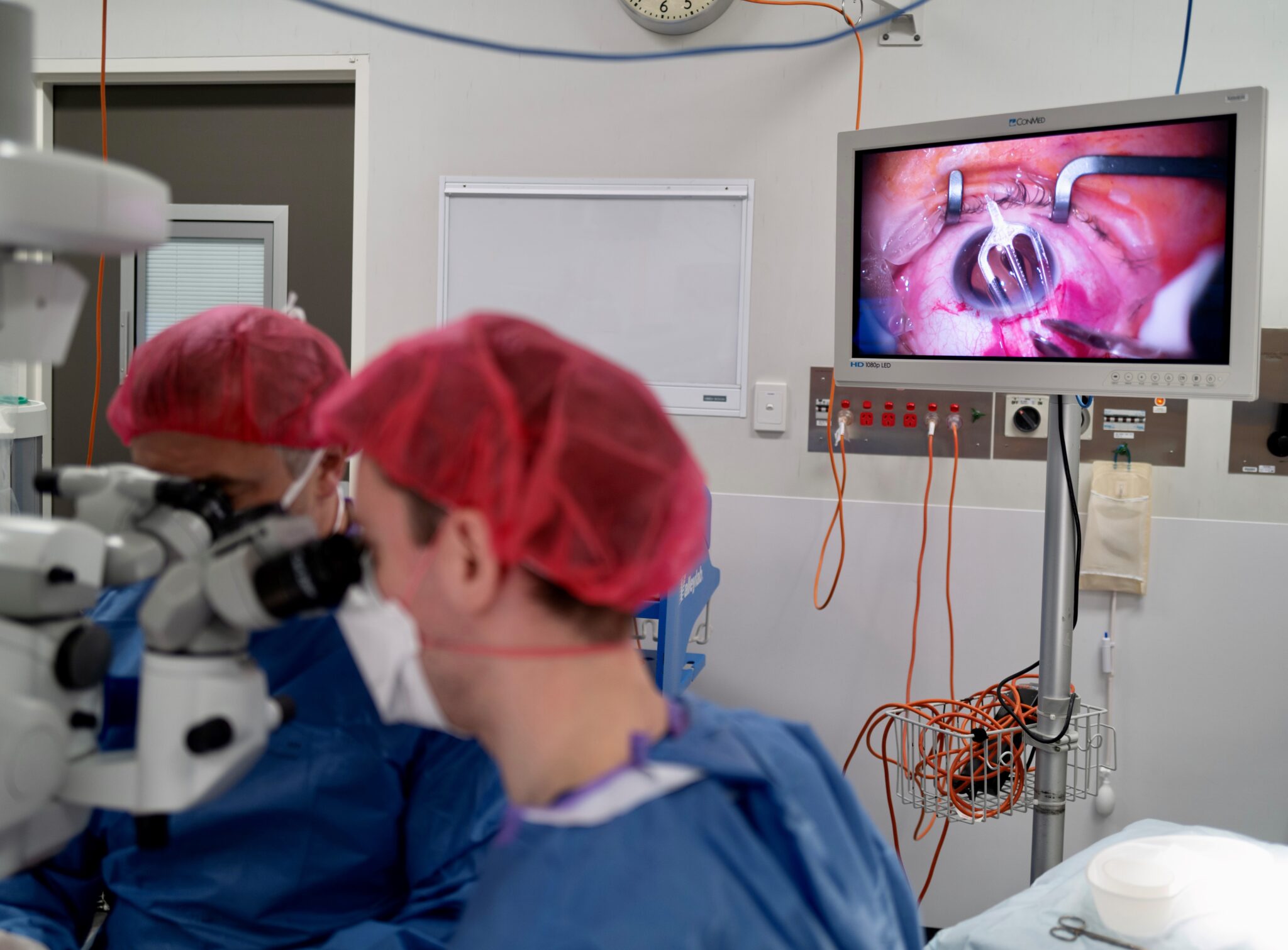 VividWhite set to transform surgical glaucoma management and vision ...